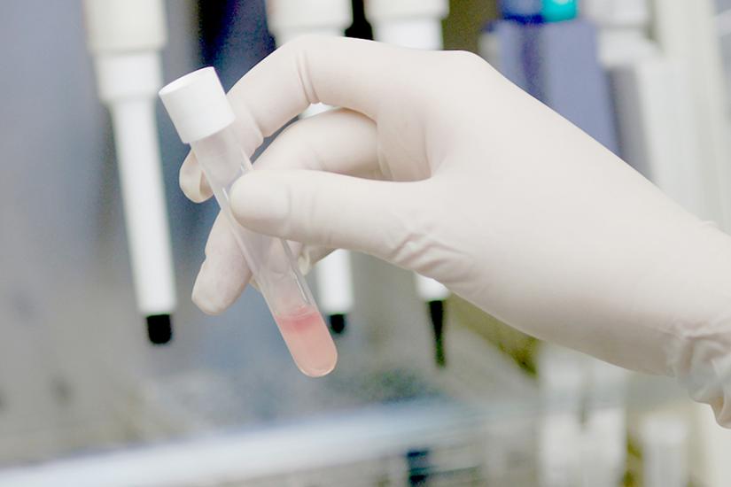 Scientists develop blood test that spots tumor-derived DNA in people ...