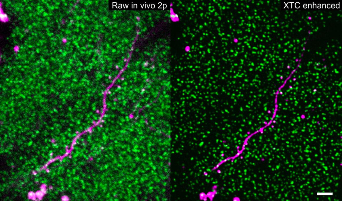 Machine learning helps scientists see how the brain adapts to different ...