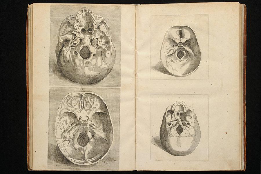 Rare books on brain surgery now at Peabody Library | Hub