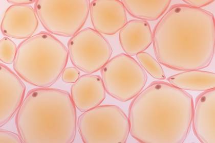 Weight-loss surgery may release toxic compounds from fat into the ...