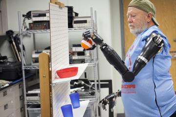 Titanium implant unlocks new levels of operability for prosthetic arm | Hub