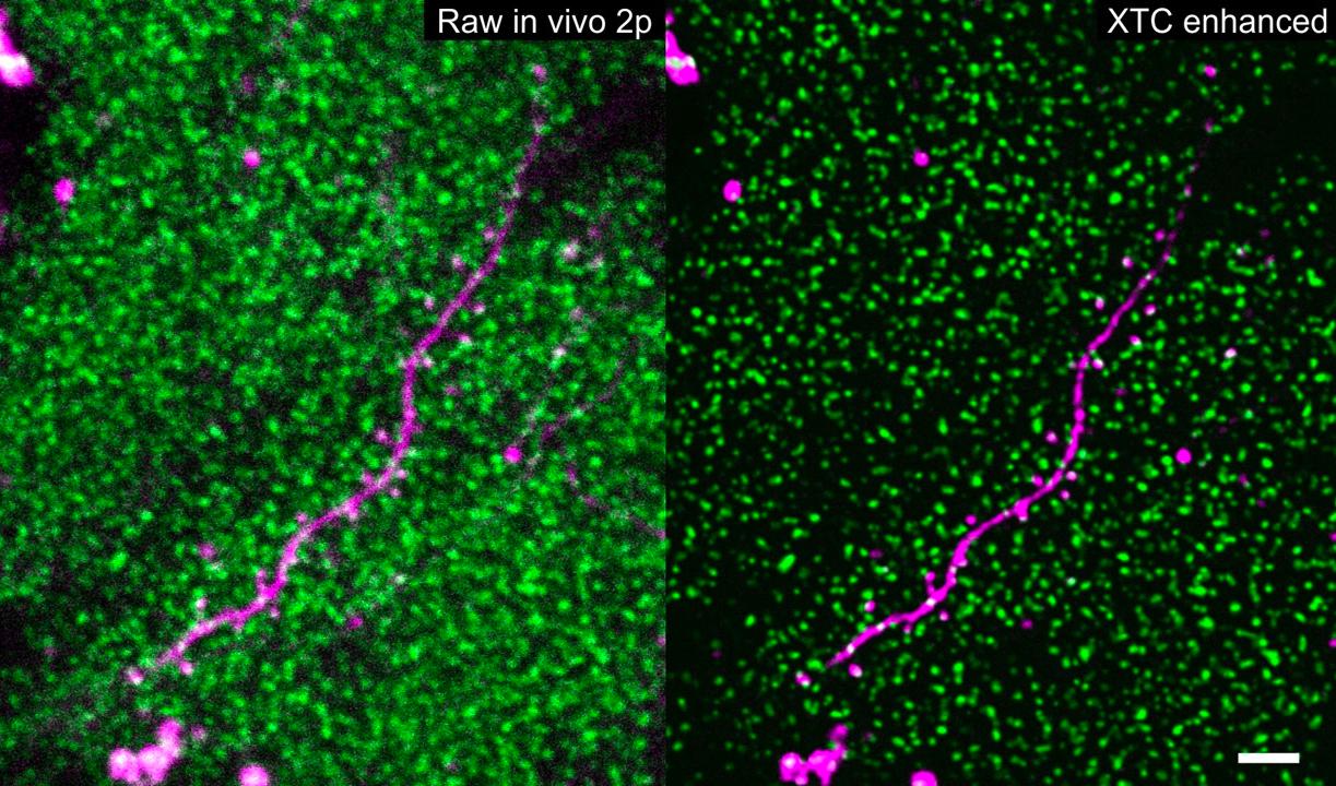 Machine learning helps scientists see how the brain adapts to different ...