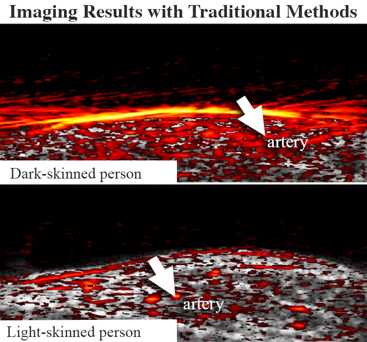 Medical imaging fails dark skin. Researchers fixed it. | Hub