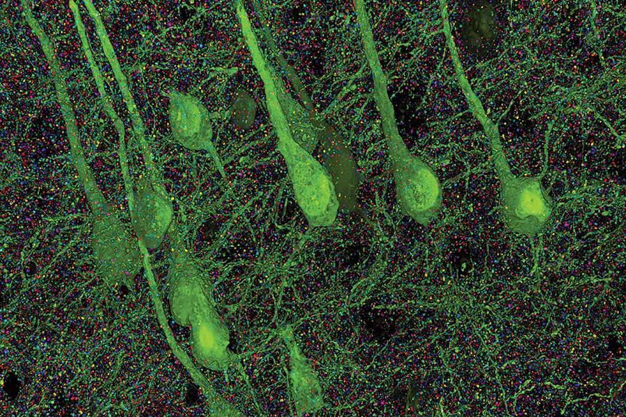 Johns Hopkins researchers want to use big data to chart the brain | Hub