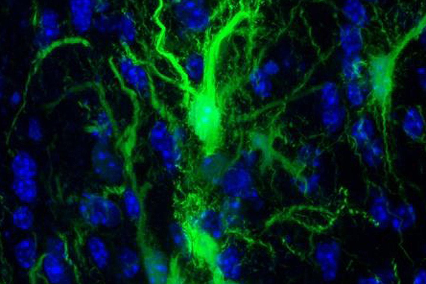 In study, transplanted brain stem cells survive without anti-rejection ...