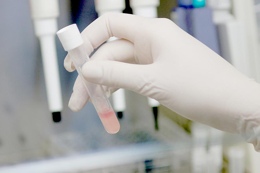 Scientists develop blood test that spots tumor-derived DNA in people ...