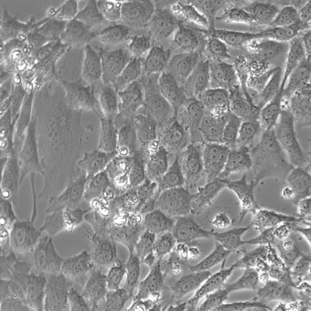 JHU researchers personalize chemotherapy drug selection | Hub