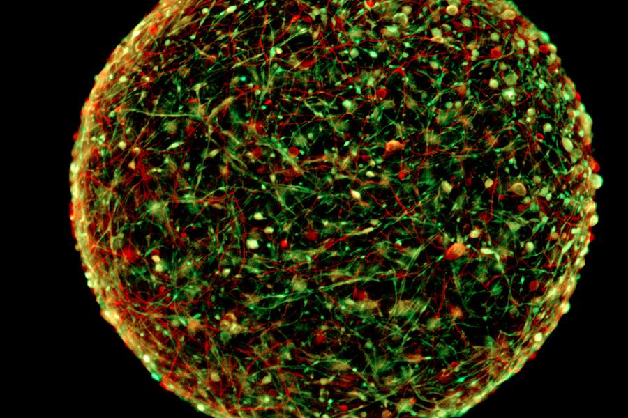 'Mini-brains' developed at Johns Hopkins could reshape brain research ...