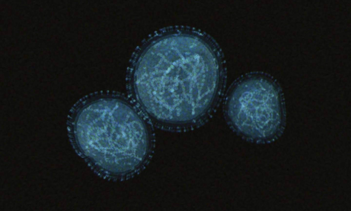 What you need to know about monkeypox | Hub