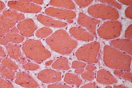 Johns Hopkins biologists find protein that bolsters growth of damaged ...