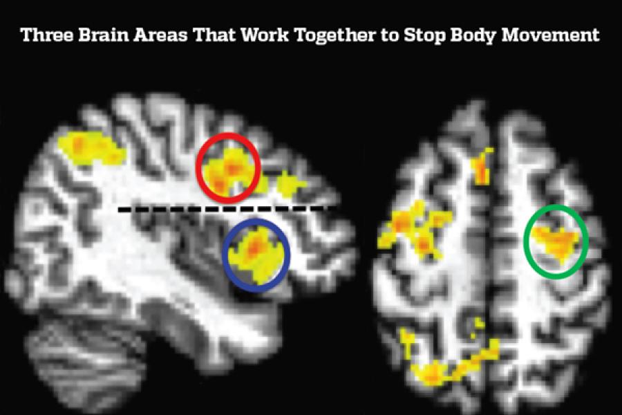 Study sheds light on how older adults may experience brain decline ...