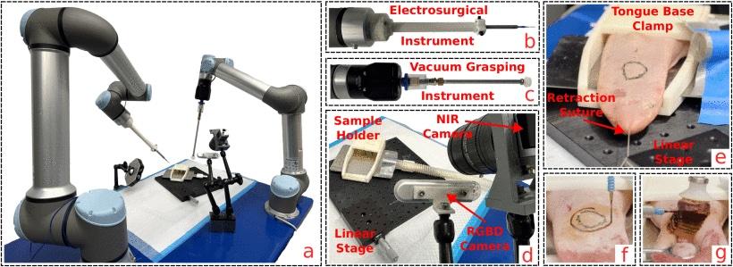 Robotic surgeon precisely removes cancerous tumors | Hub