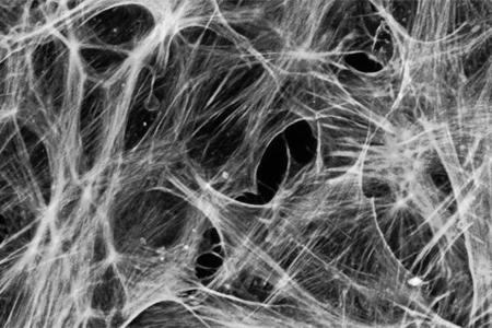 Water-based 'engine' propels cancer cells through body's tight spaces ...