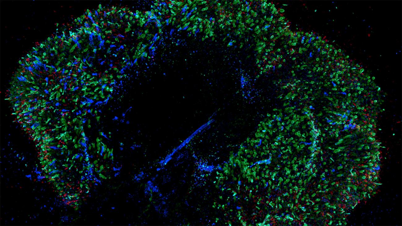 Human retinas grown in a dish explain how color vision develops | Hub
