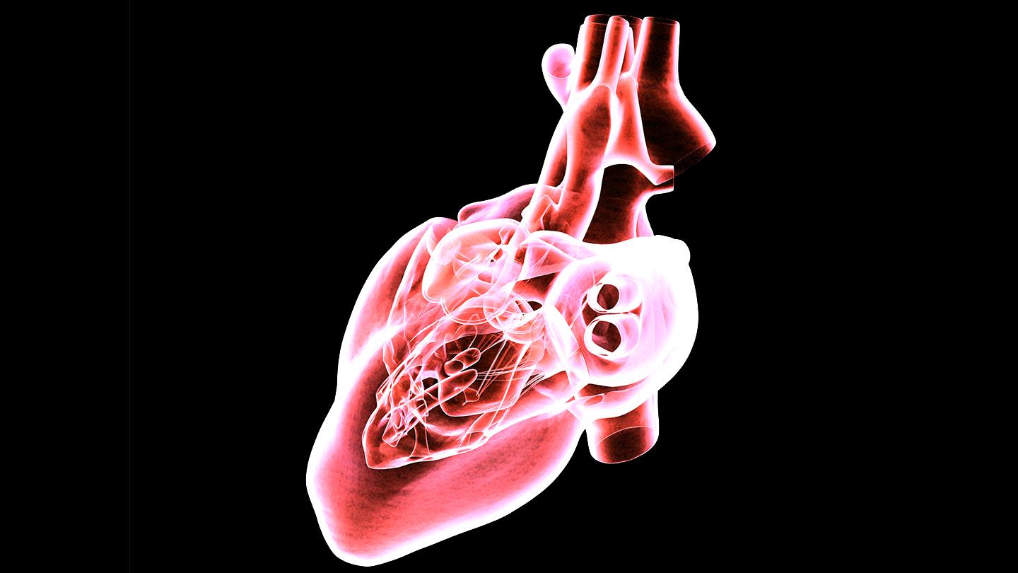Personalized 3-D virtual simulations get to the heart of cardiac ...