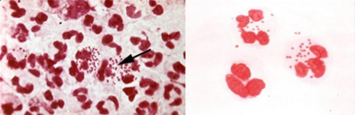 NIH awards $5.1M to Hopkins team developing fast diagnostic tool for ...