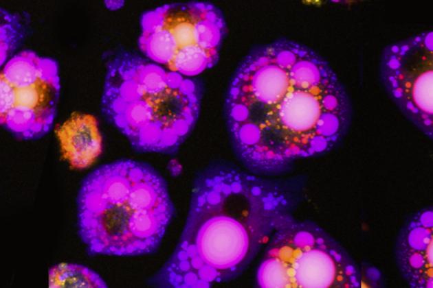 Low copper levels linked to fatter fat cells | Hub